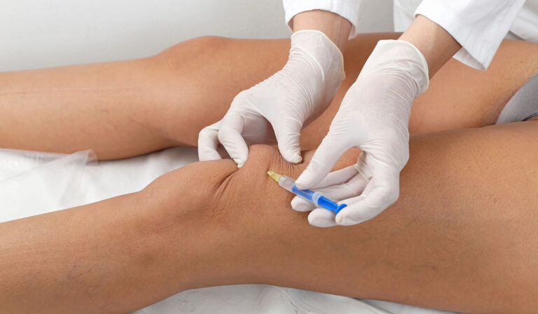 Botox Therapy for Chronic Pain: How It Works and What to Expect - Nexus ...